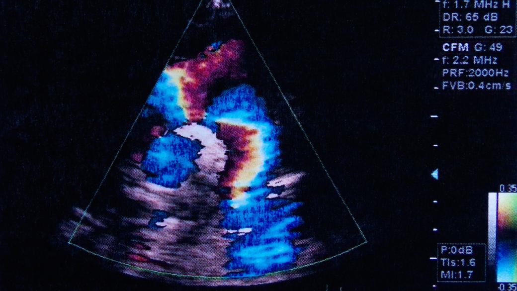 Research Areas | Department of Pediatrics