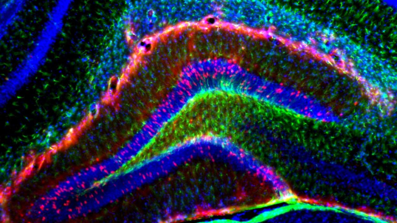 Kernie Lab | Department of Pediatrics